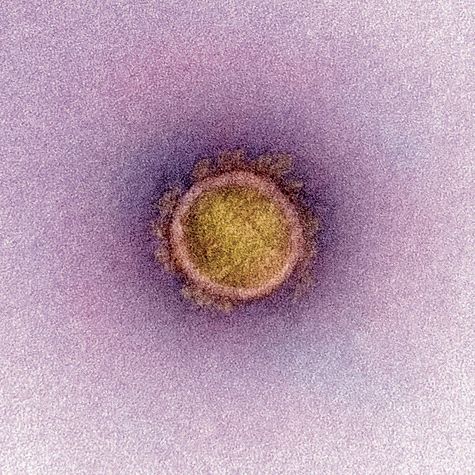 The Year of the Virus - Cosentino Japan